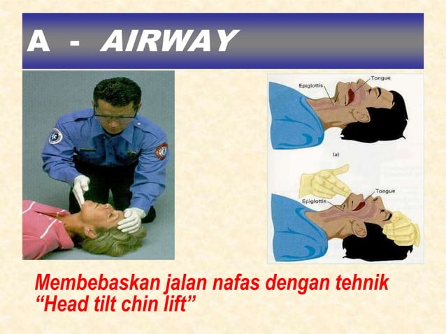 RJP RESUSITASI JANTUNG PARU | PPTX