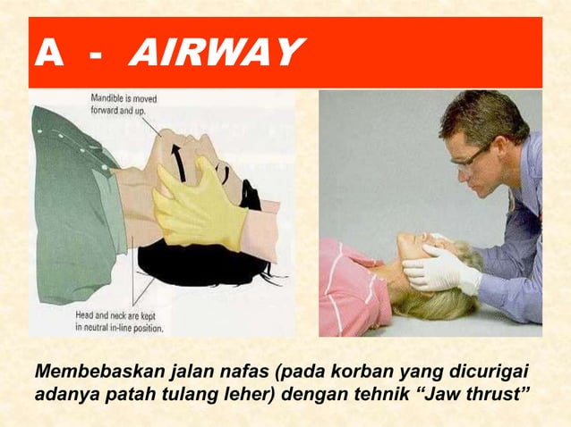 RJP RESUSITASI JANTUNG PARU | PPTX