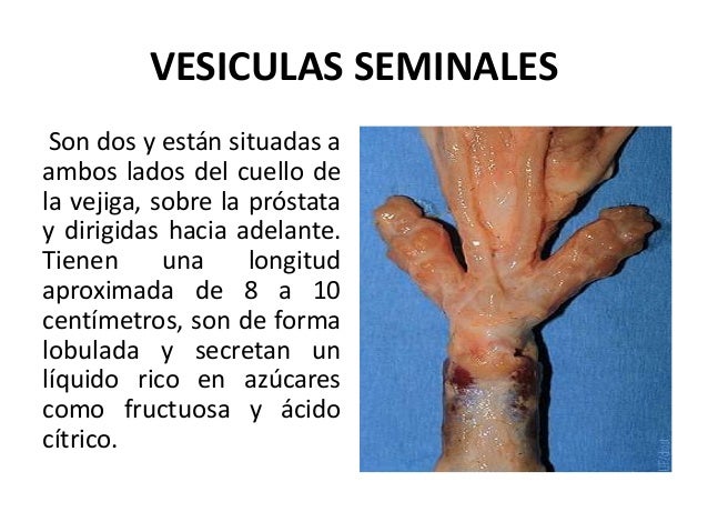 ANATOMIA DEL SISTEMA REPRODUCTOR MASCULINO