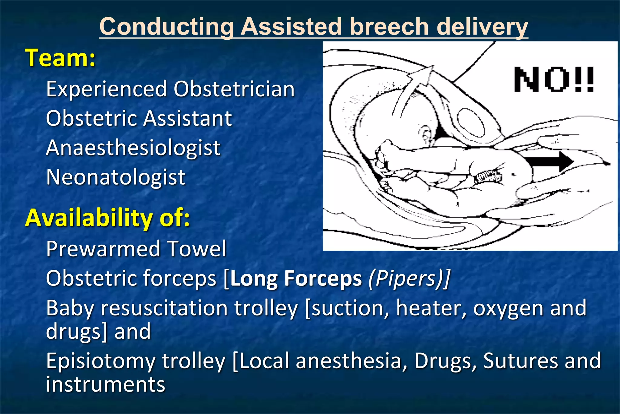 Breech Obstetrics. | PDF