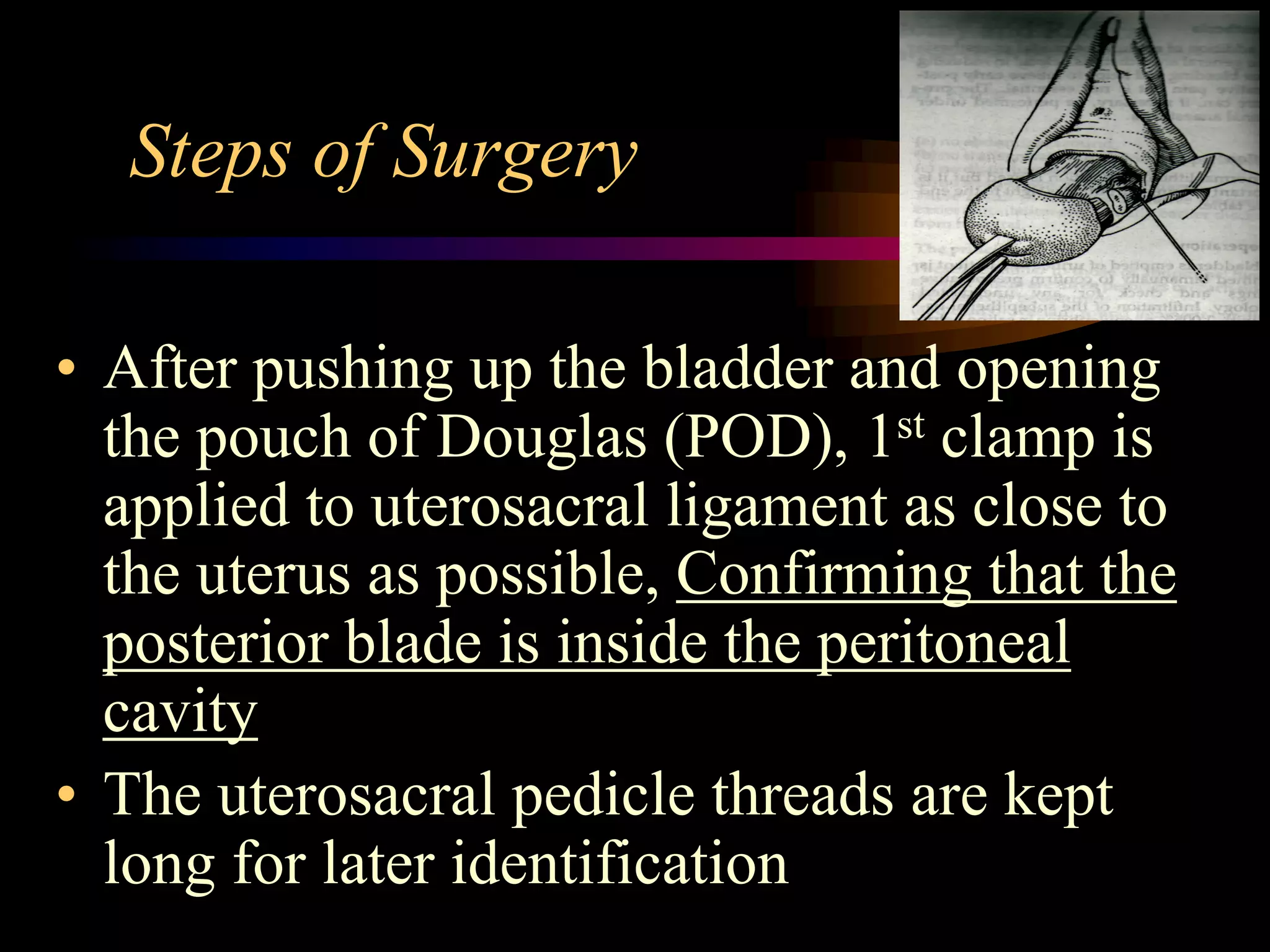 Vaginal Hysterectomy | PDF