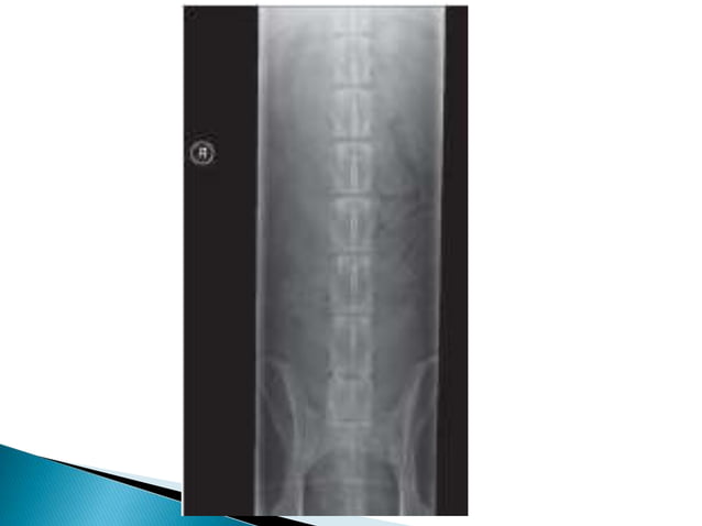 Rkvy radiographic positioning of dog | PPTX | Medical Tests | Medical ...