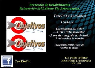 Rotura del Labrum de la Cadera | PDF