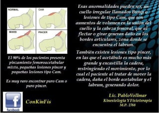 Rotura del Labrum de la Cadera | PDF