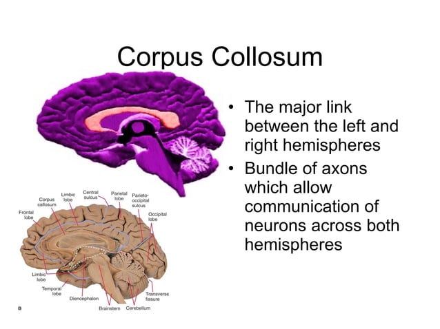 Right Left Hemispheres Ppt 5390