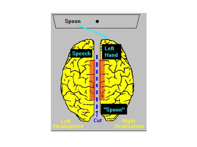 Right Left Hemispheres | PPT