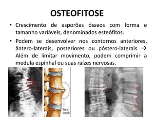 RM COLUNA VERTEBRAL | PPT