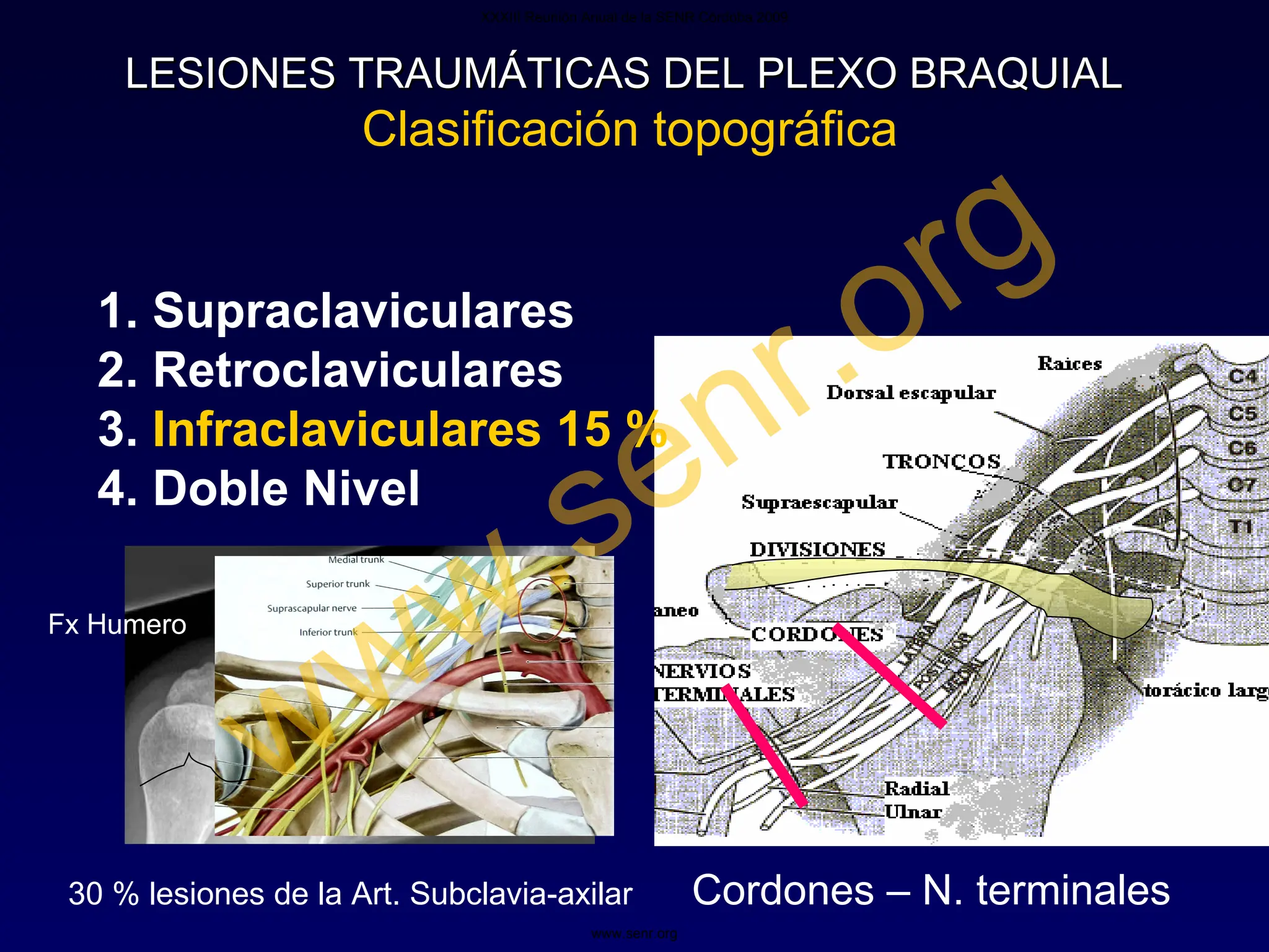 RM DE PLEXOS CERVICALES IMAGENES DIAGBOSTICA | PPT