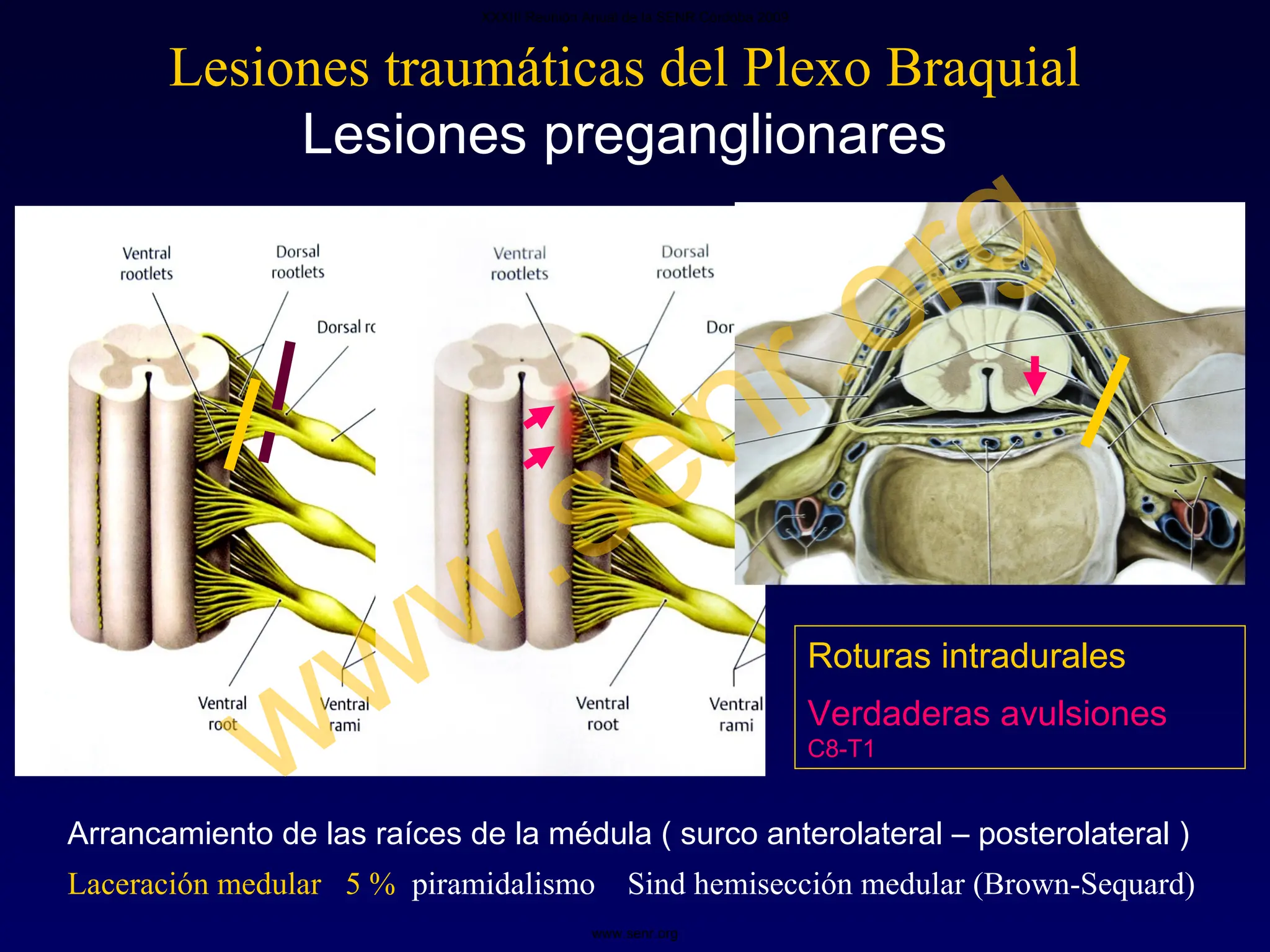 RM DE PLEXOS CERVICALES IMAGENES DIAGBOSTICA | PPT