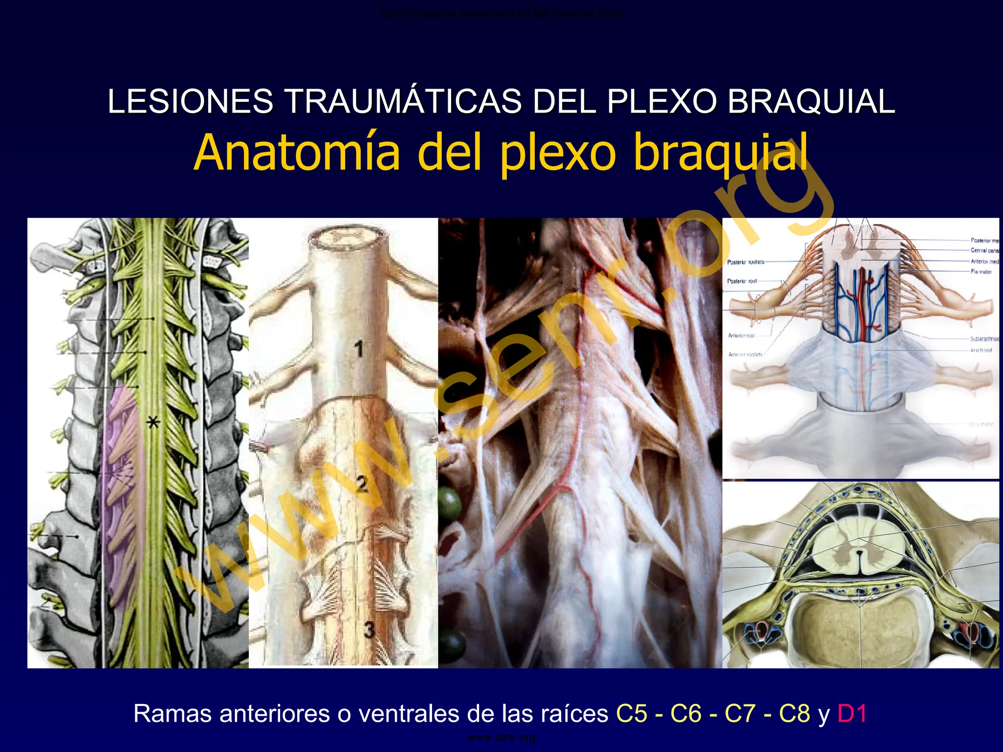 RM DE PLEXOS CERVICALES IMAGENES DIAGBOSTICA | PPT