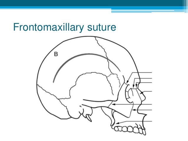 Frontomaxillary Suture