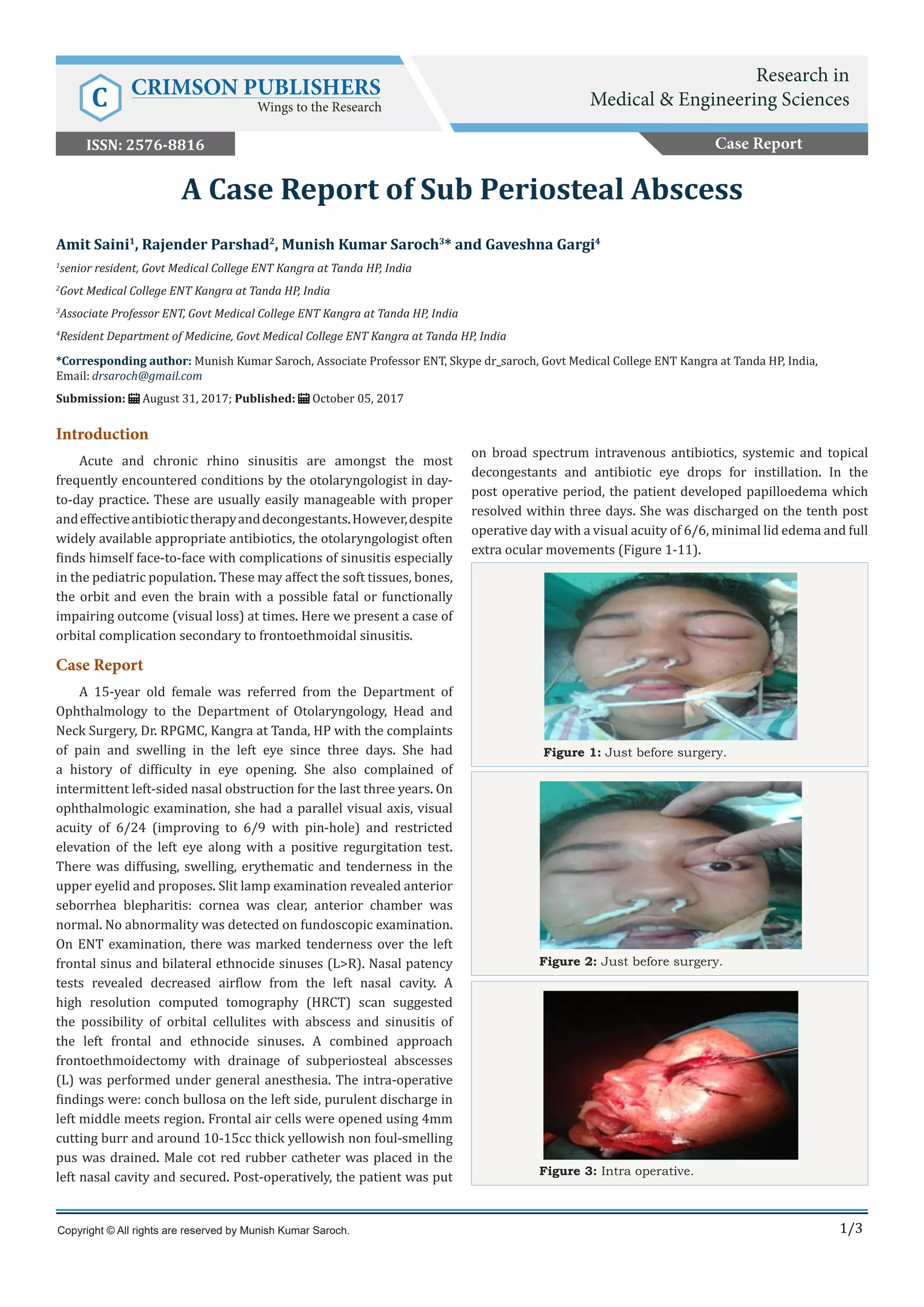 A Case Report of Sub Periosteal Abscess | Crimson Publishers | PDF