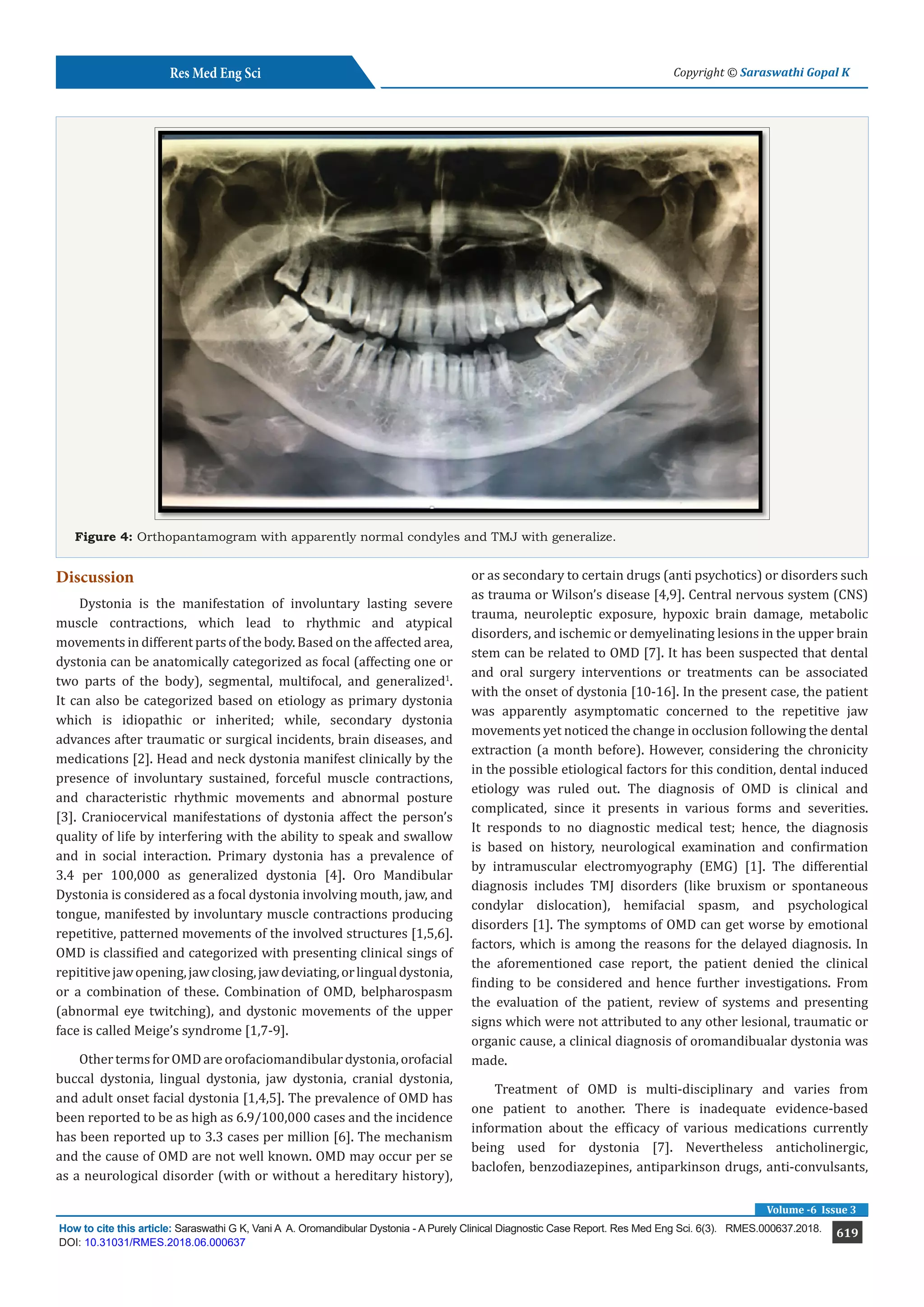 Oromandibular Dystonia - A Purely Clinical Diagnostic Case Report | PDF