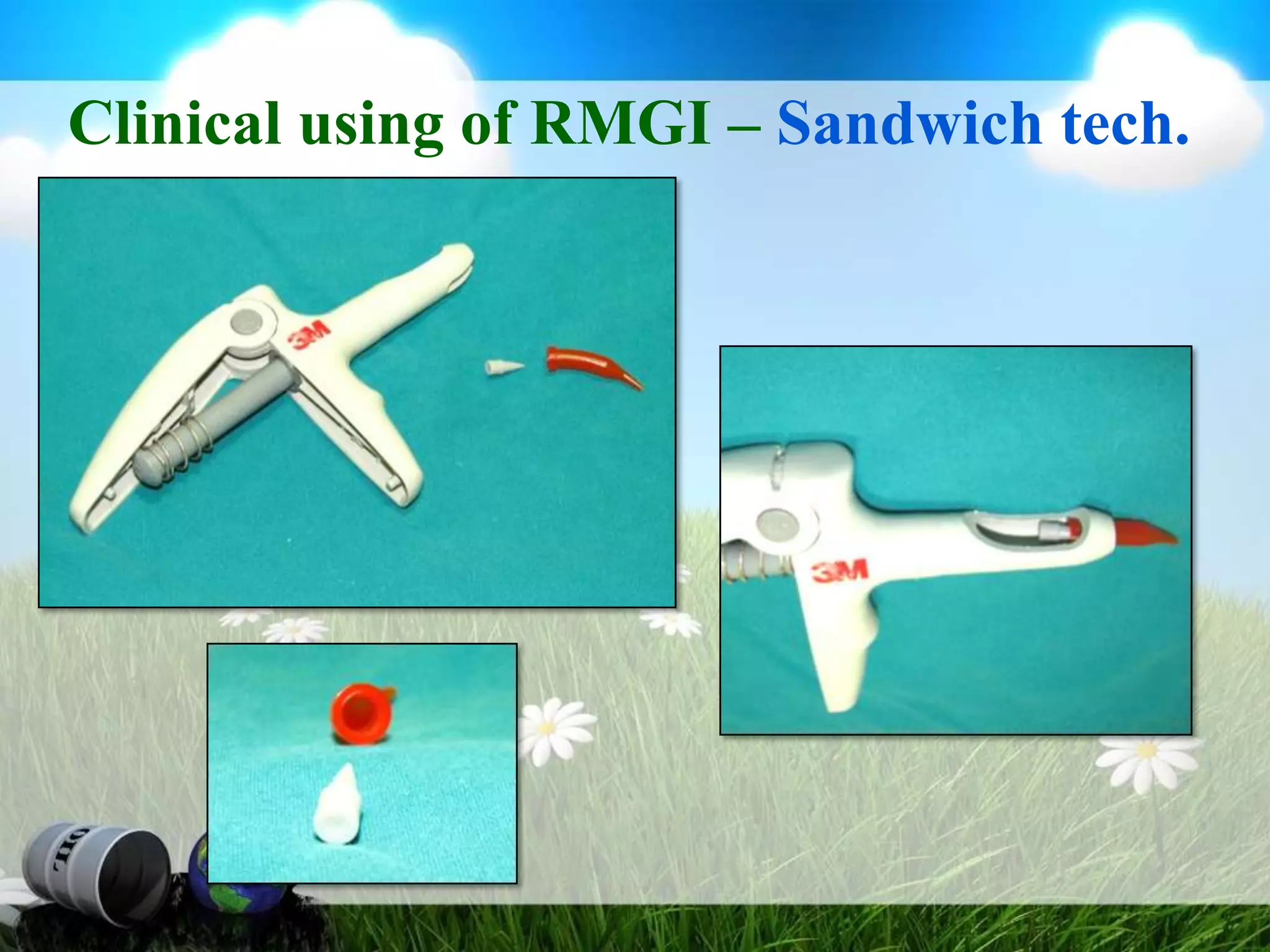 Resin Modified Glassionomer cement | PPTX