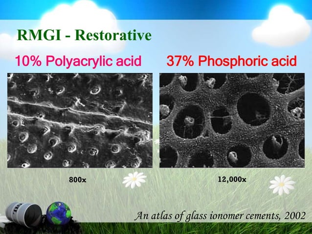 Resin Modified Glassionomer cement | PPTX