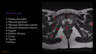 Resonancia Magnética De La Anatomía De Los Músculos Pélvicos