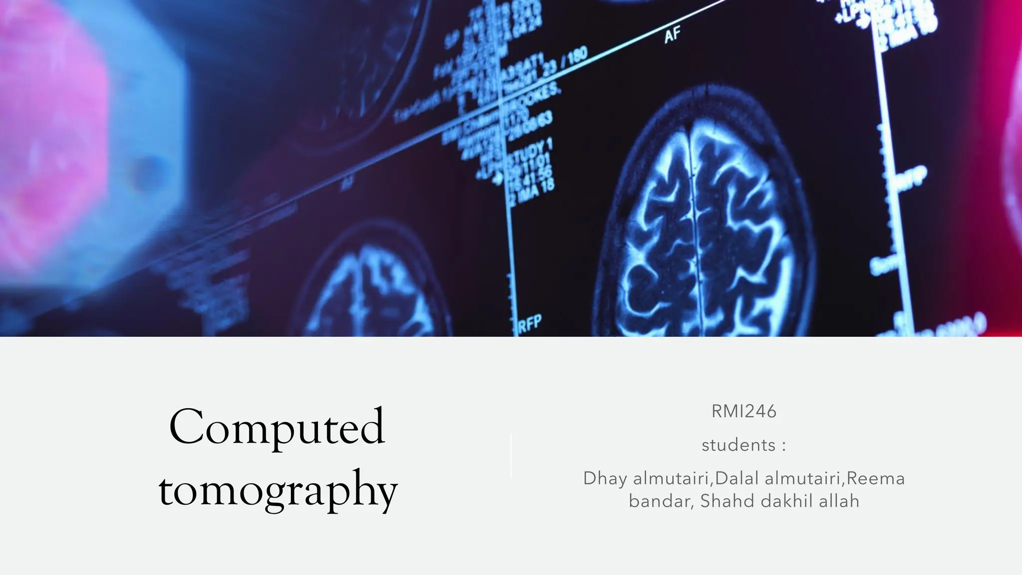 Introduction to Computed tomography and updates | PDF