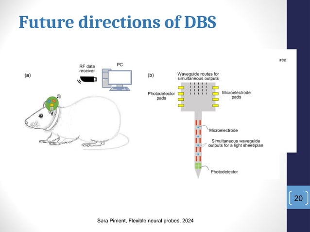Deep Brain Stimulation (DBS) and targets.ppt