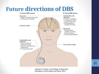 Deep Brain Stimulation (DBS) and targets.ppt