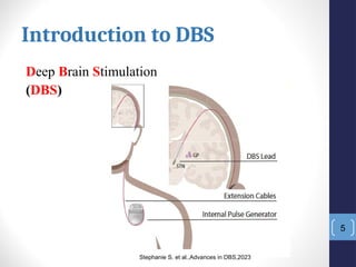 Deep Brain Stimulation (DBS) and targets.ppt