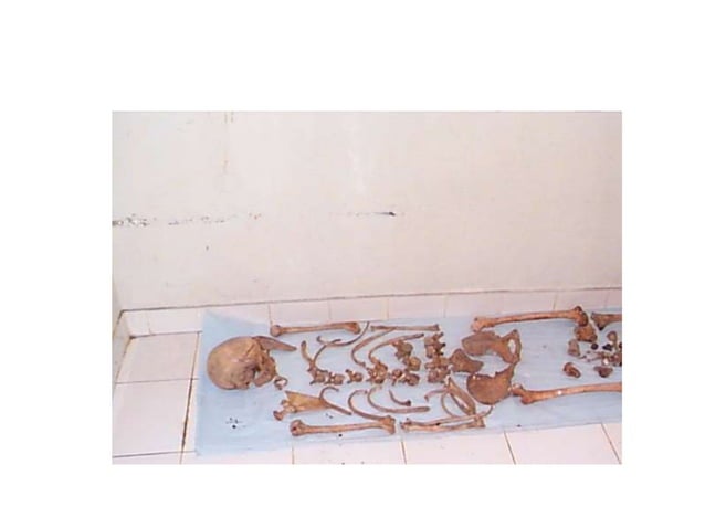 Rmo mil trauma | PPTX