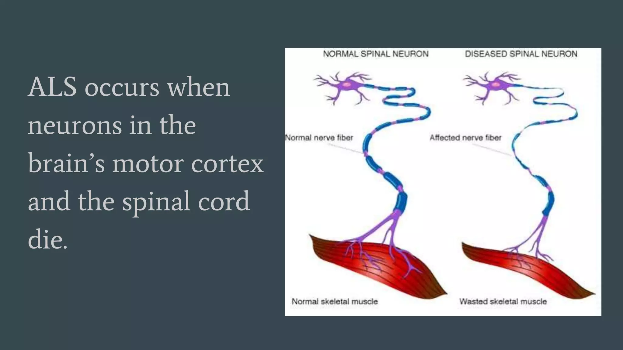 ALS Presentation | PPT