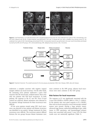 Rhabdomyosarcoma Of head and neck | PDF
