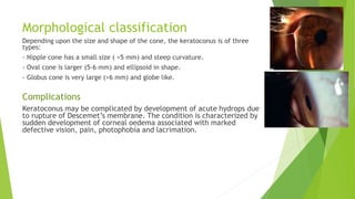 Abnormalities of Shape of Cornea and Corneal Opacity.pptx | Eye and ...
