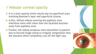 Abnormalities of Shape of Cornea and Corneal Opacity.pptx