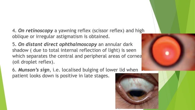 Abnormalities of Shape of Cornea and Corneal Opacity.pptx