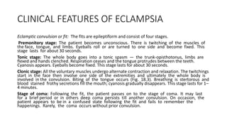 ECLAMPSIA AND ITS MANAGEMENT.pptx