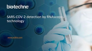 SARS-COV-2 detection by RNAscope technology | PDF | Genetics | Science