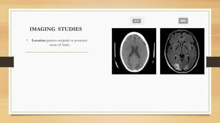 reversible neurological diseases | PPTX | Brain and Nervous System ...