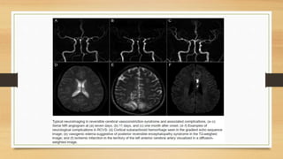 reversible neurological diseases | PPTX | Brain and Nervous System ...