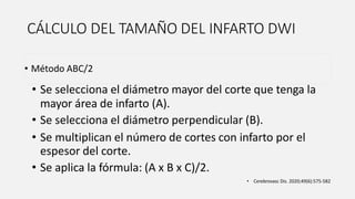 La Resonancia Magnética Nuclear En caso de STROKE agudos | PPTX