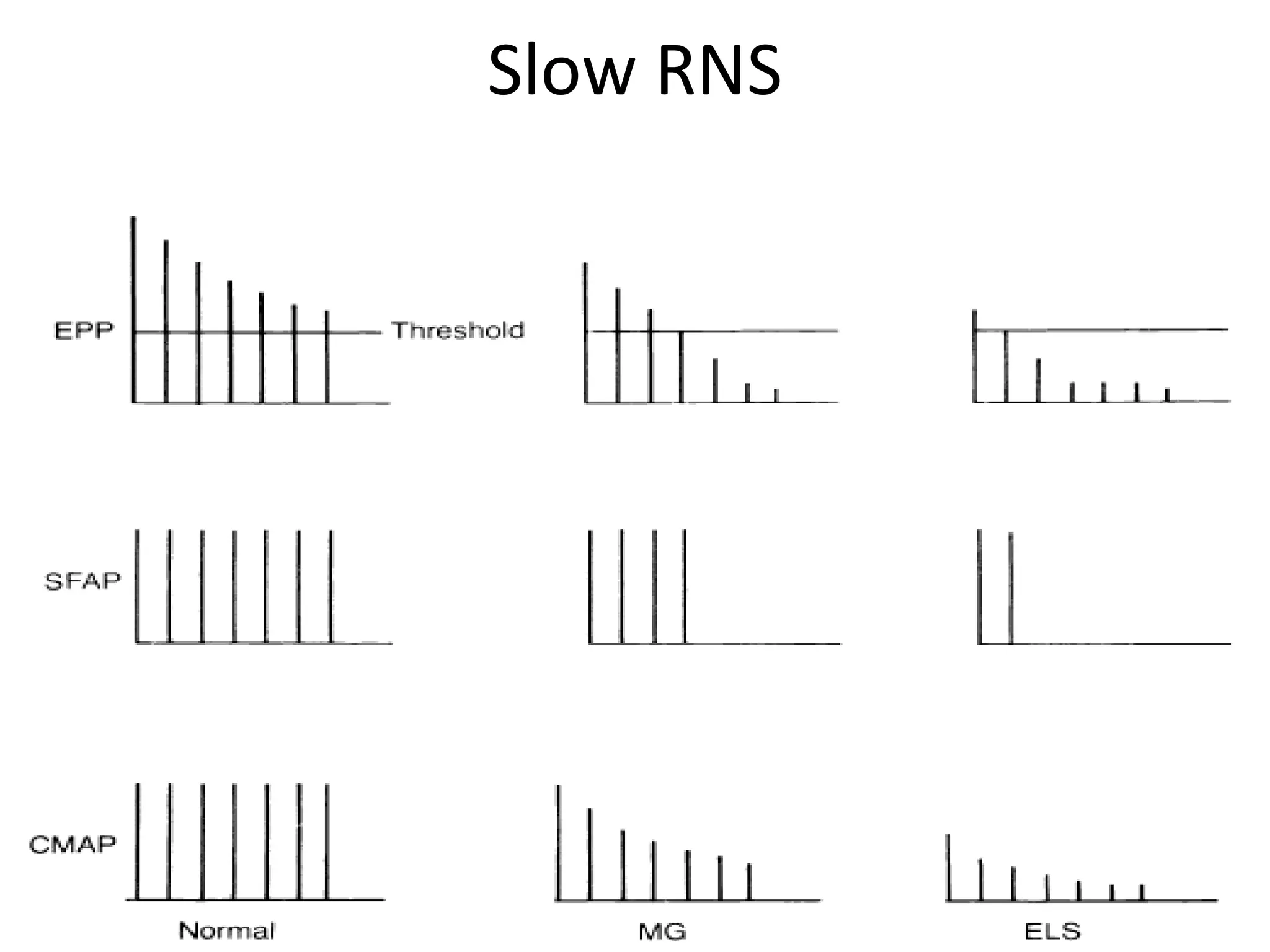 REPETITIVE NERVE STIMULATION (RNS) | PPT