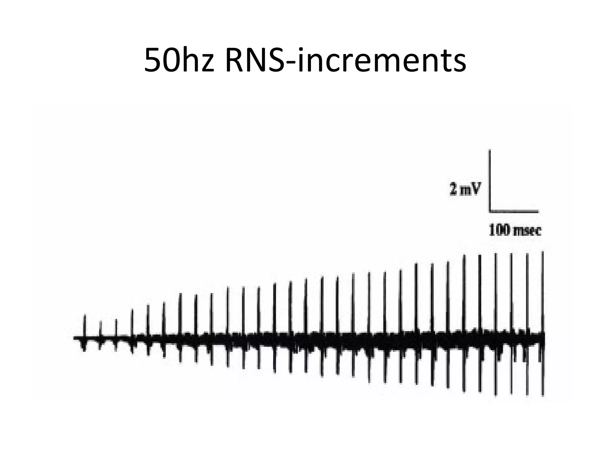REPETITIVE NERVE STIMULATION (RNS) | PPT