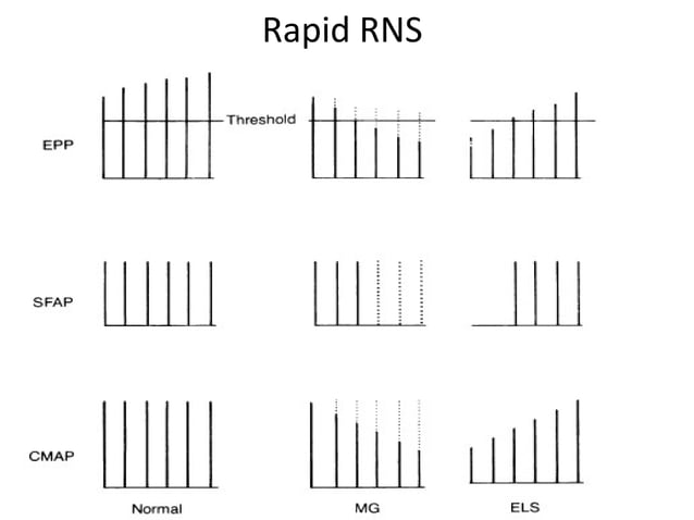 REPETITIVE NERVE STIMULATION (RNS) | PPT