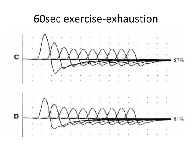 REPETITIVE NERVE STIMULATION (RNS) | PPT
