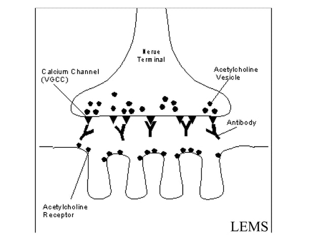 REPETITIVE NERVE STIMULATION (RNS) | PPT