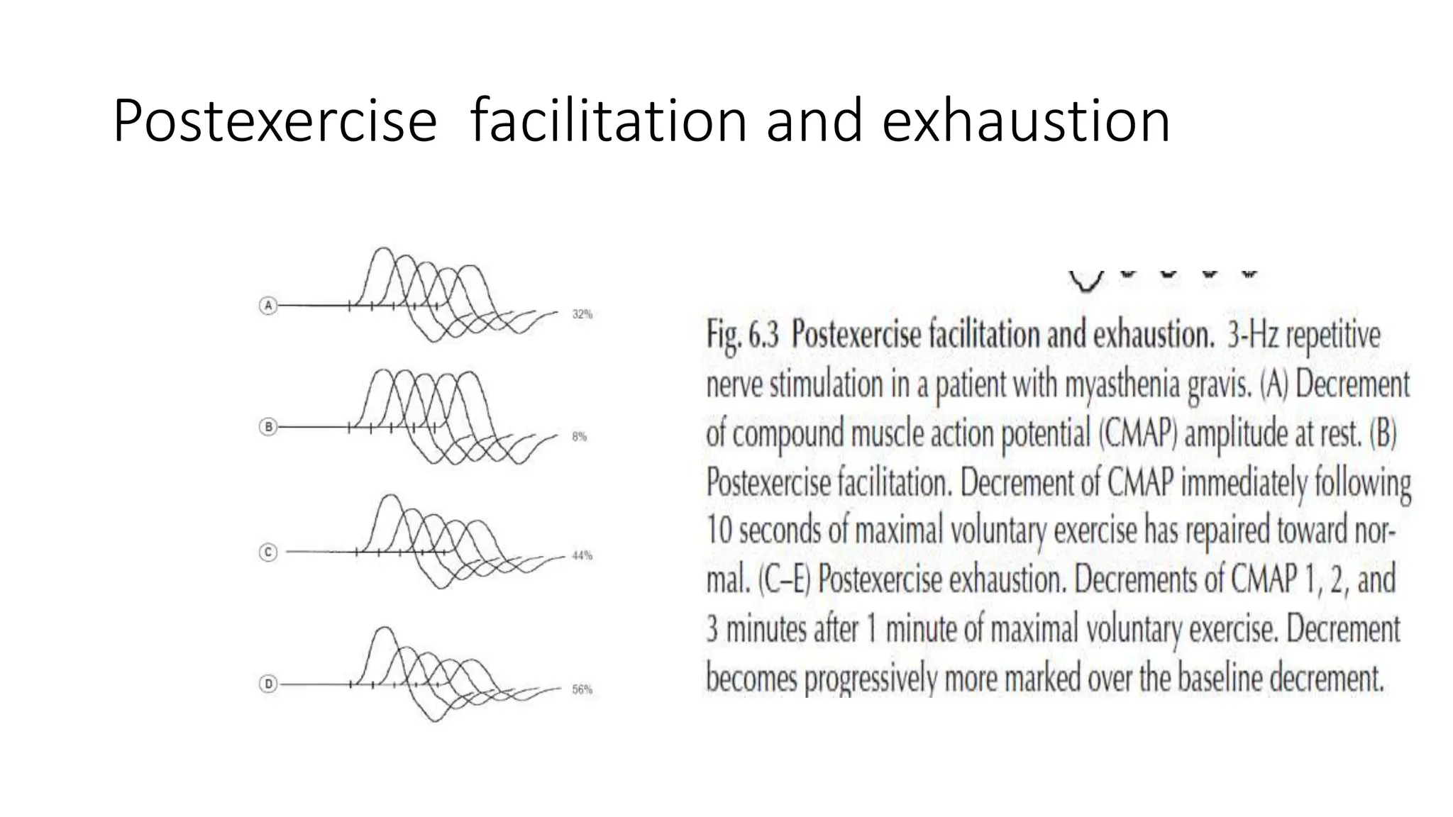 RNS diagnosis of myasthenia and lambert eaton .pptx