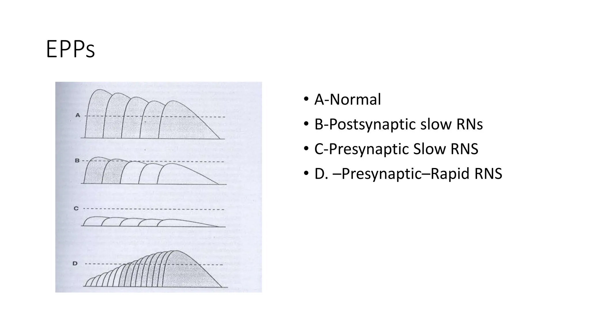 RNS diagnosis of myasthenia and lambert eaton .pptx