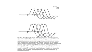 RNS diagnosis of myasthenia and lambert eaton .pptx