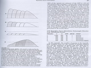 Repetitive Nerve Stimulation (RNS) | PPT