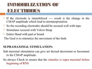 Repetitive Nerve Stimulation (RNS) | PPT