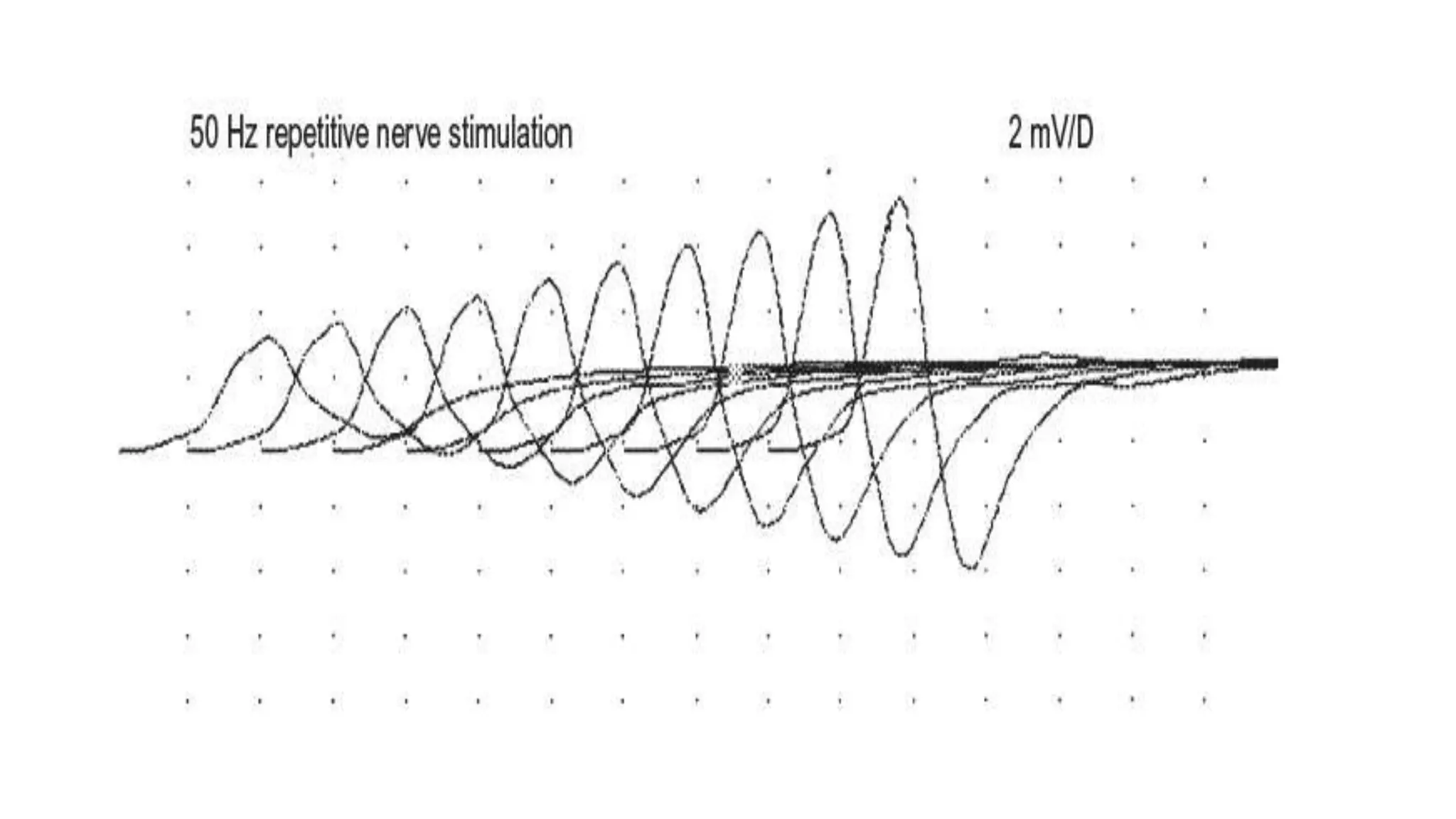 Repetitive nerve stimulation test | PPTX
