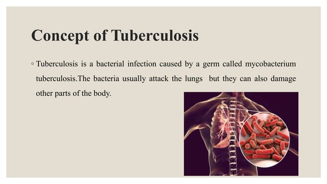 Revised National Tuberculosis Control programme.pptx | Infectious ...
