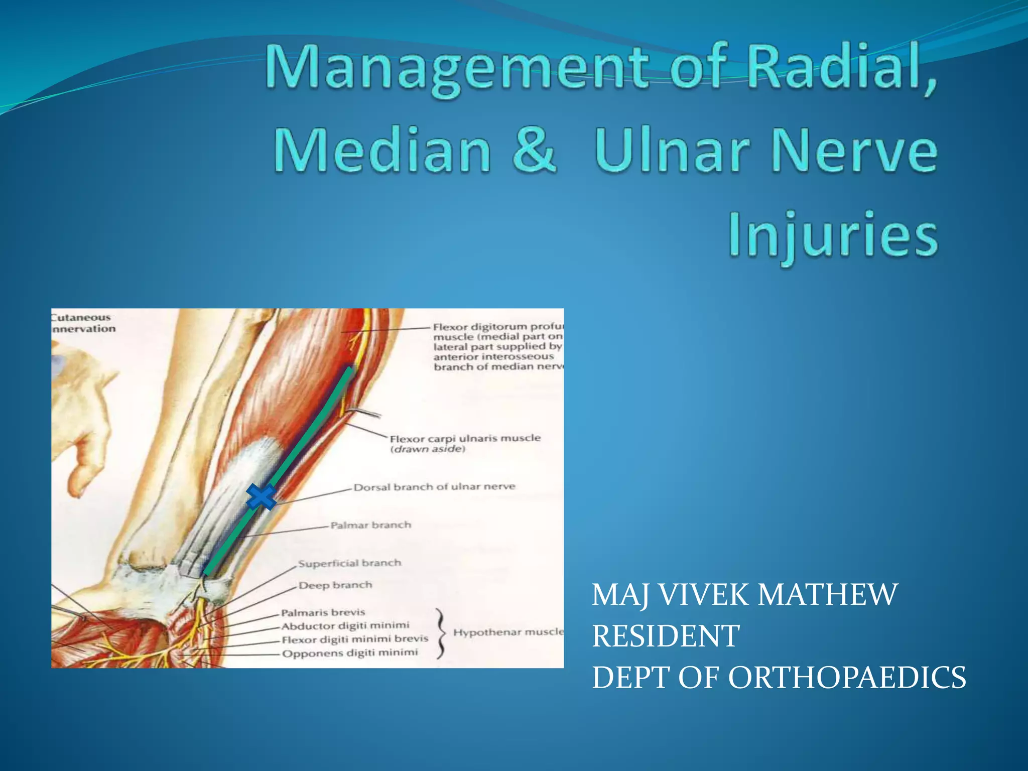 peripheral nerve injuries | PPTX