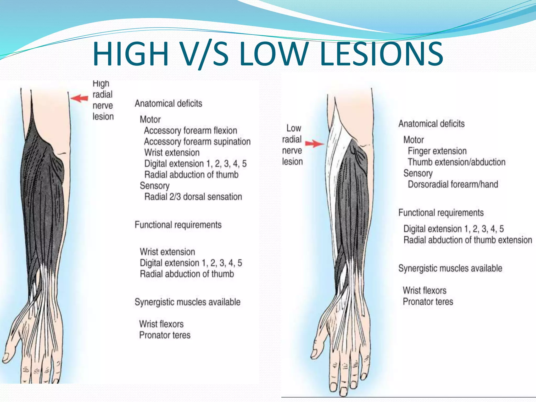 peripheral nerve injuries | PPTX