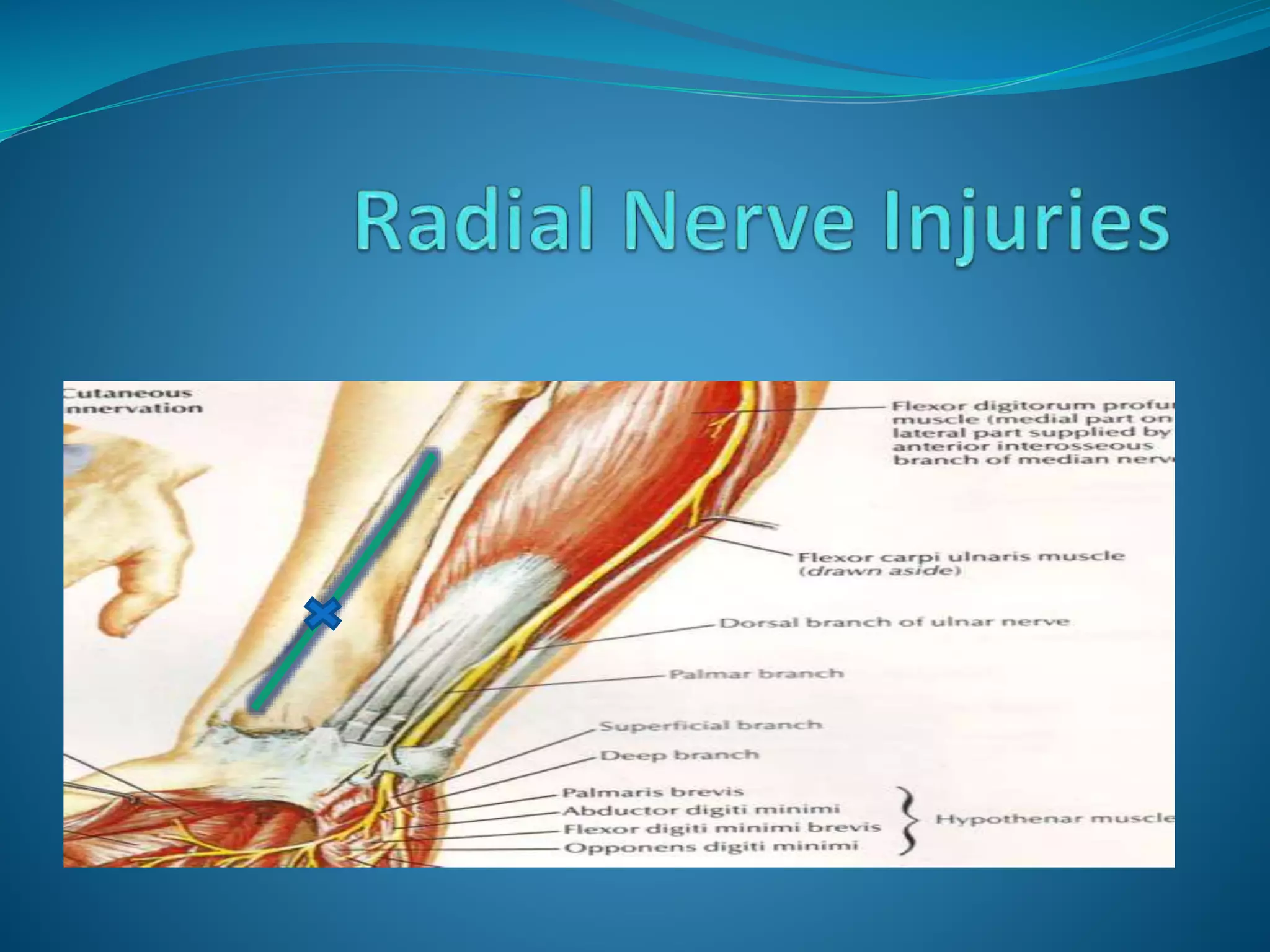 peripheral nerve injuries | PPTX